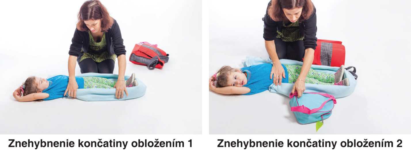 Zlomeniny, podvrtnutia, vykĺbeniny a poranenia svalov - Happy baby SK